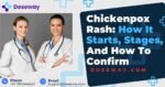 Chickenpox Rash: How It Starts, Stages, Confirm, & Images