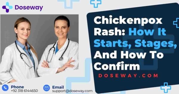 Chickenpox Rash: How It Starts, Stages, Confirm, & Images